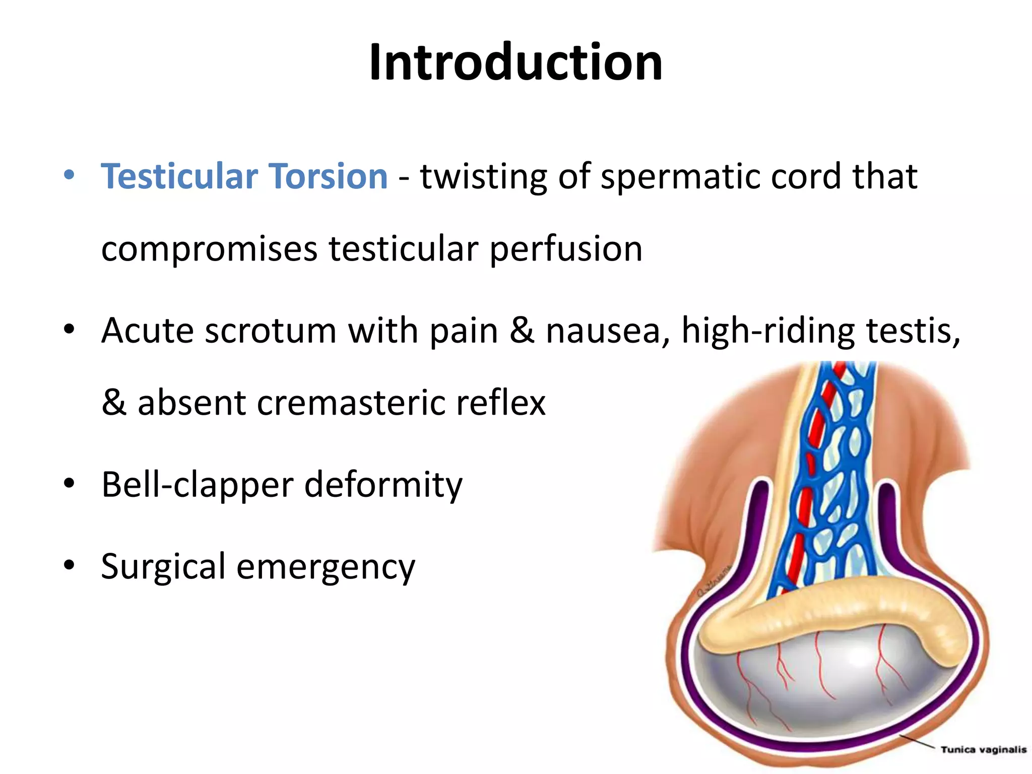 Torsion testis - Operative chat | PPTX