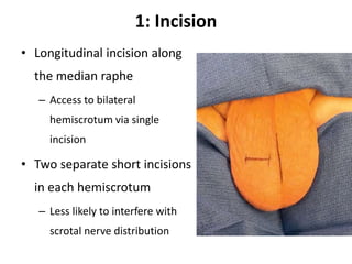 Torsion testis - Operative chat | PPTX