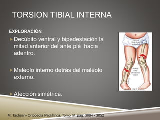 Torsion tibial | PPT