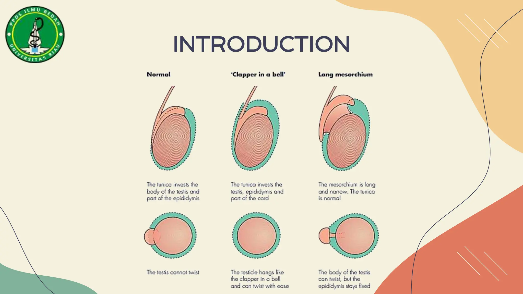 TORSIO TESTIS presentasion fixxed NEW.pptx