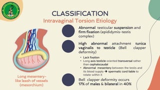 TORSIO TESTIS presentasion fixxed NEW.pptx