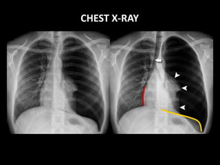 Torso trauma.pptx