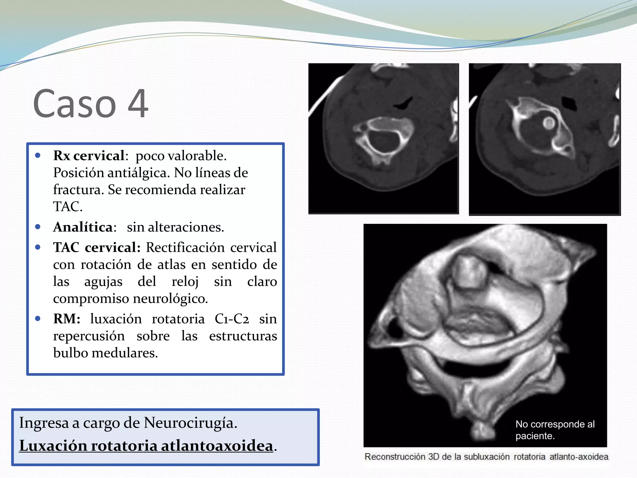 Tortícolis adquirida en pediatría. Evaluación en urgencias. Miriam Nova ...