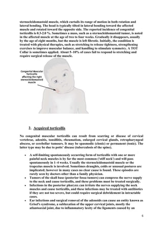Torticollis | DOCX