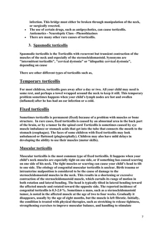 Torticollis | DOCX