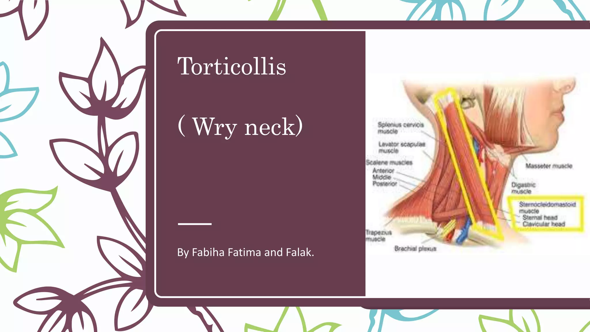 Torticollis and its P.T. Management | PPTX