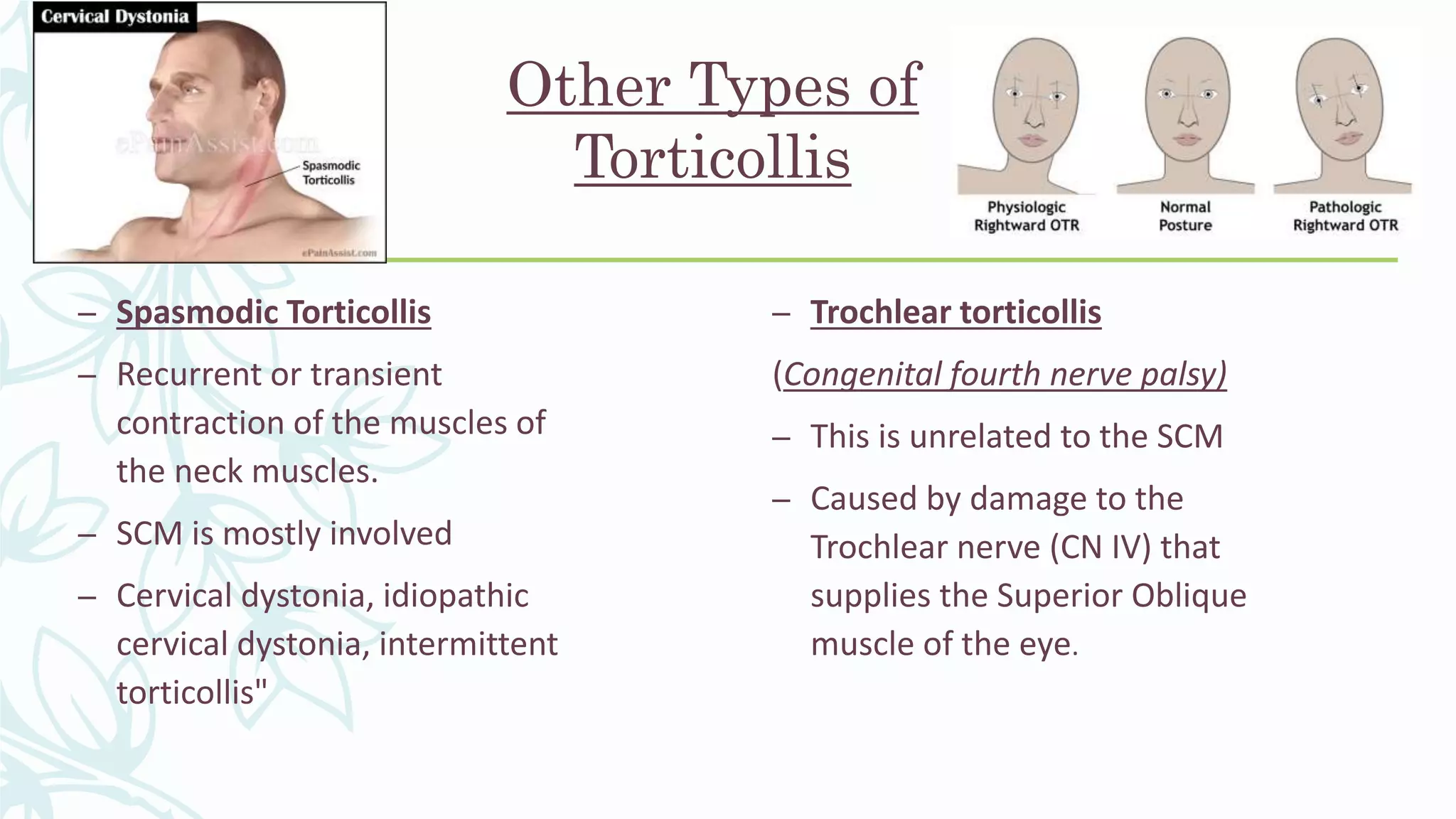 Torticollis and its P.T. Management | PPTX
