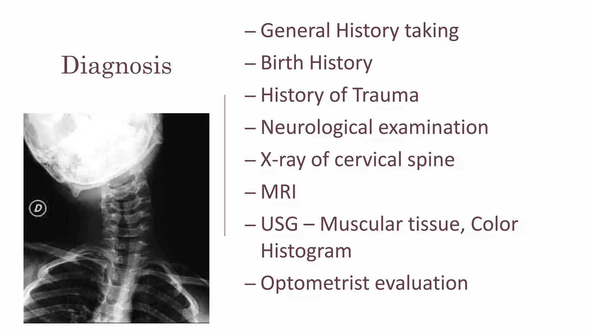 Torticollis and its P.T. Management | PPTX