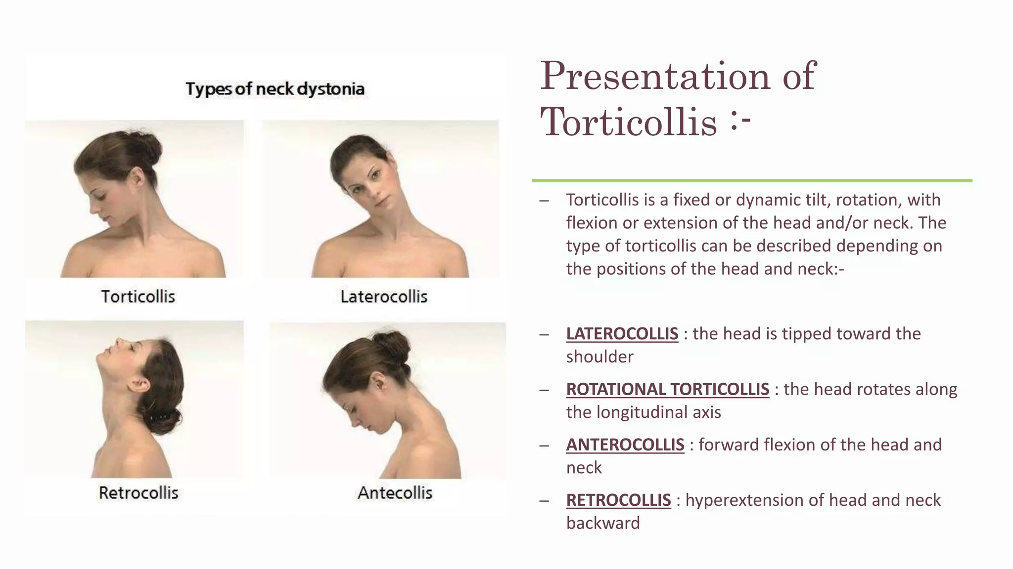 Torticollis and its P.T. Management | PPTX