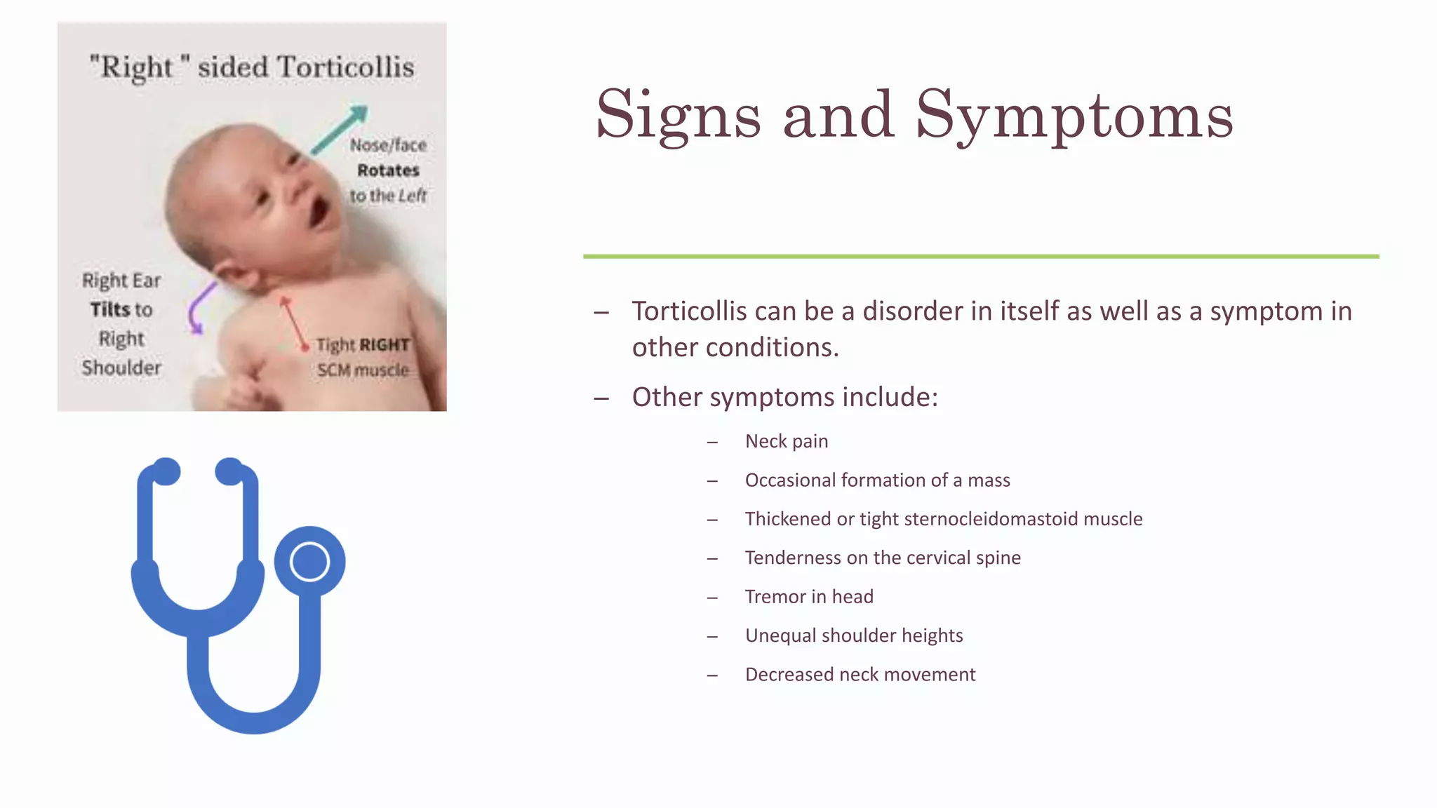 Torticollis and its P.T. Management | PPTX