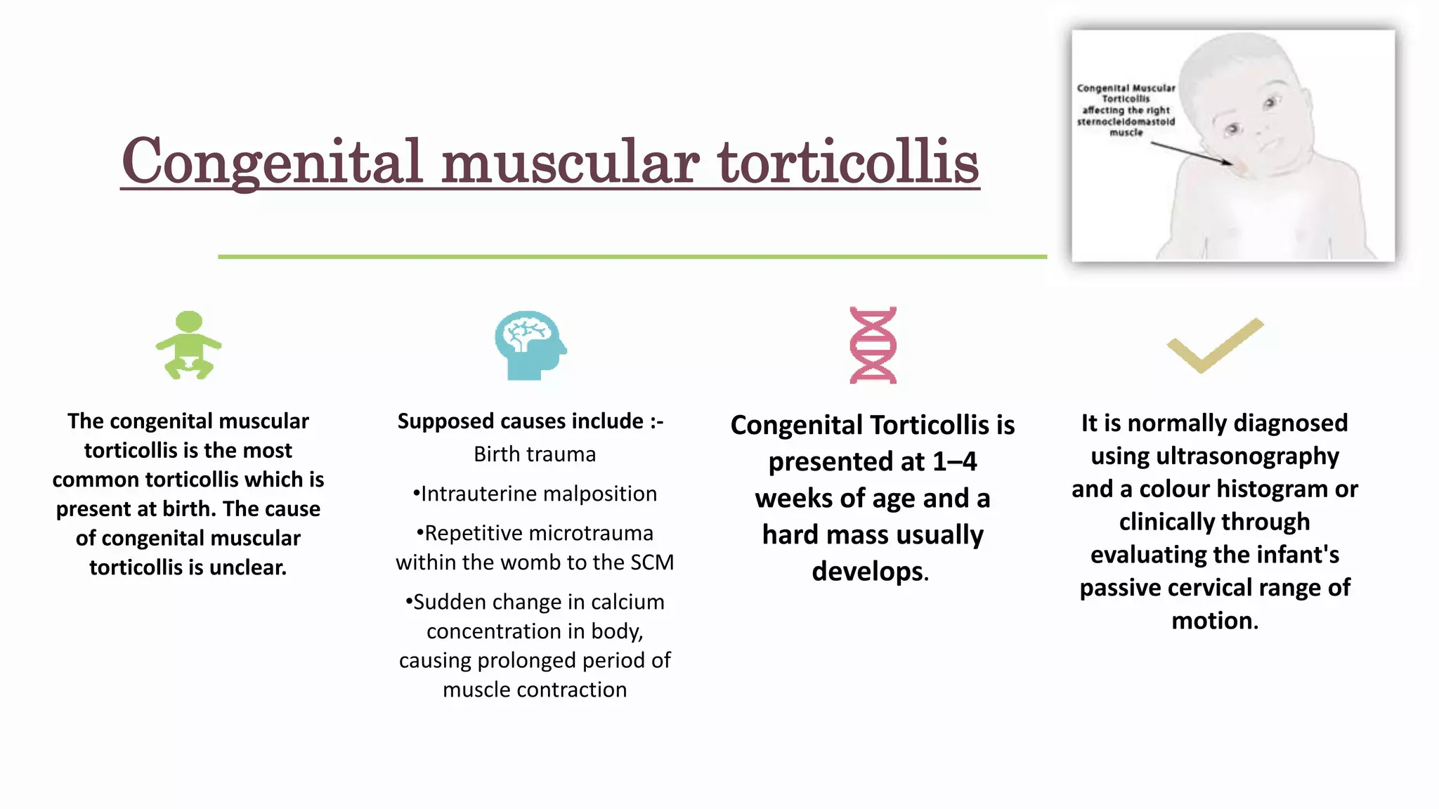 Torticollis and its P.T. Management | PPTX
