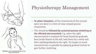 Torticollis and its P.T. Management | PPTX