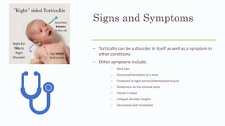 Torticollis and its P.T. Management | PPTX