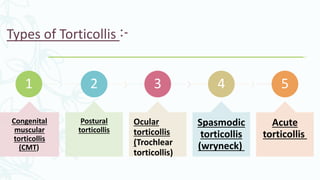 Torticollis and its P.T. Management | PPTX