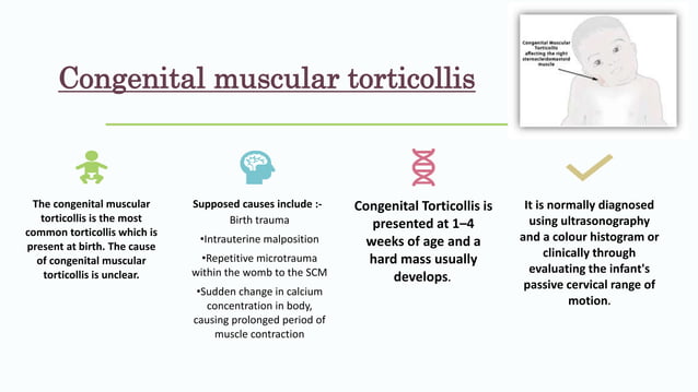 Torticollis and its P.T. Management | PPTX