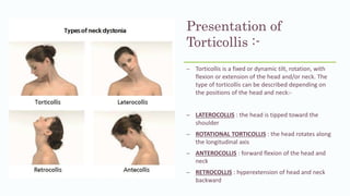 Torticollis and its P.T. Management | PPT