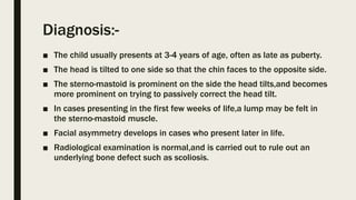 Torticollis.HR
