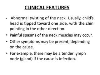 Torticollis | PPTX