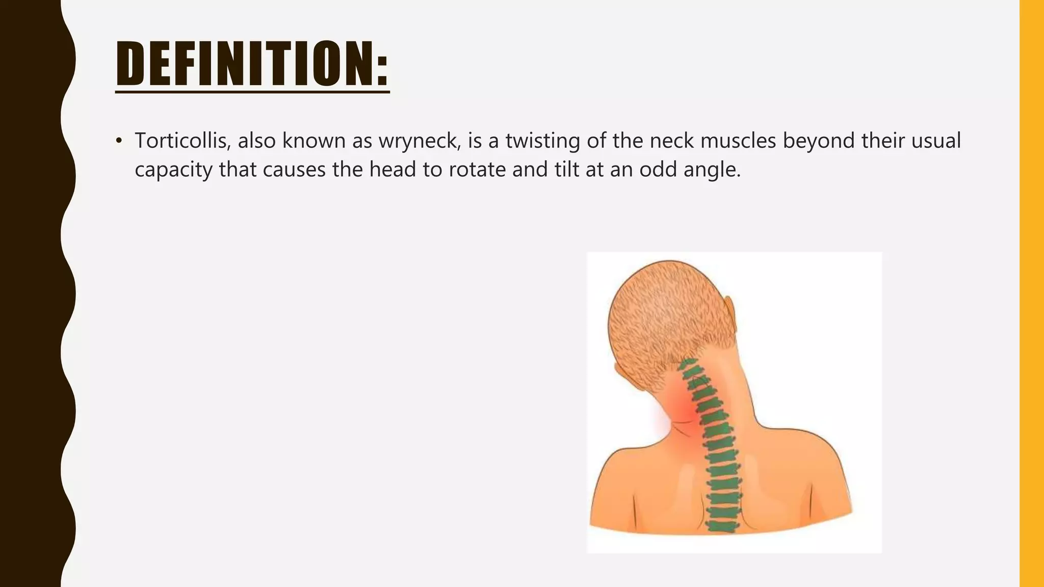 Torticollis | PPTX