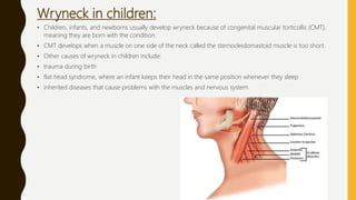 Torticollis | PPTX