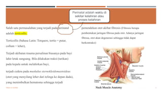 Torticollis.pptx