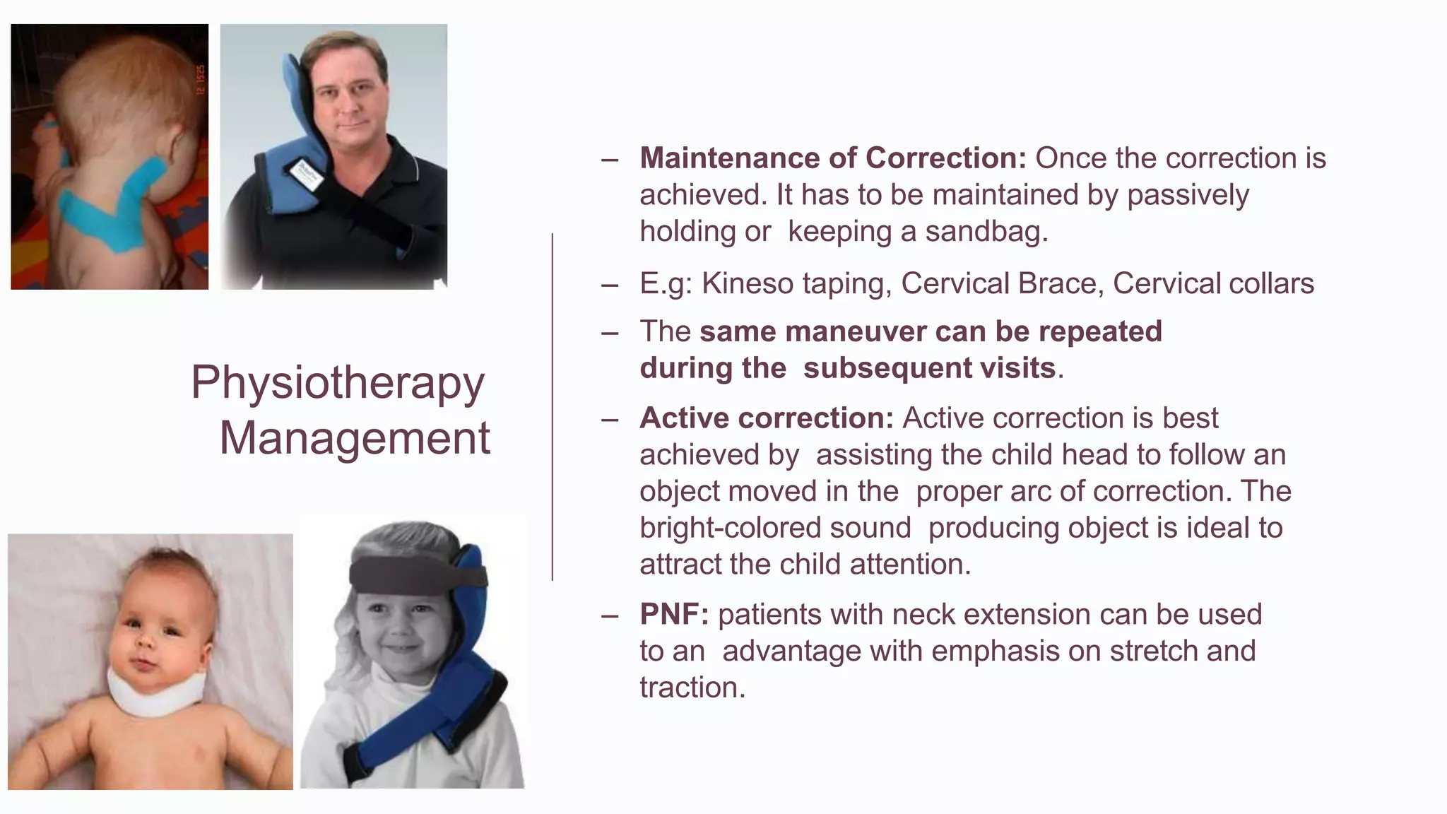 torticollis- cervical rib.pptx