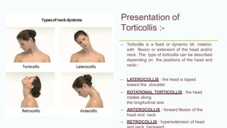 torticollis- cervical rib.pptx