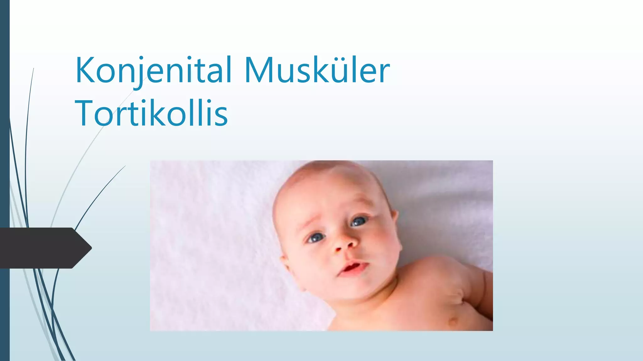 Tortikollis | PPT
