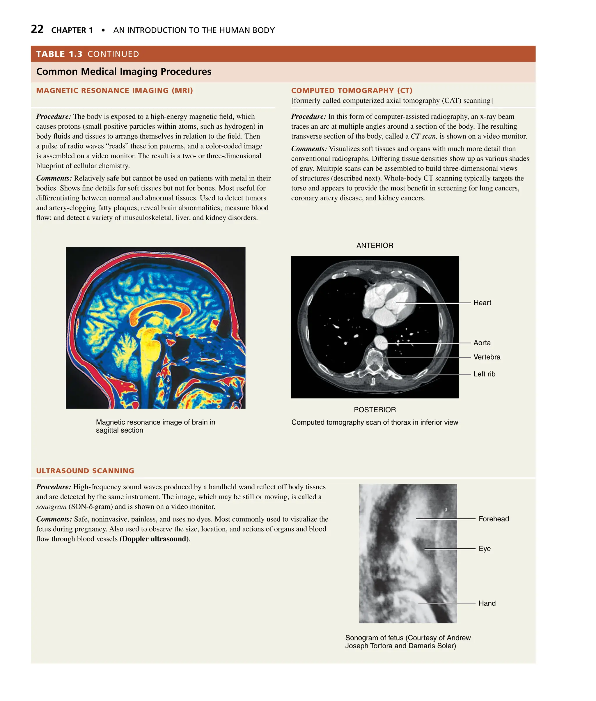 Tortora PRINCIPLES OF ANATOMY AND PHYSIOLOGY - Tortora - 14th Ed.pdf