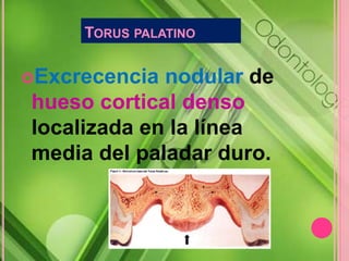 Torus | PPTX