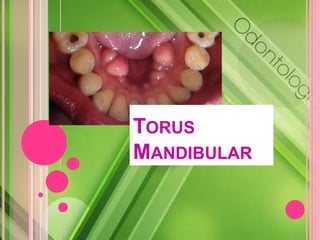 Torus | PPTX