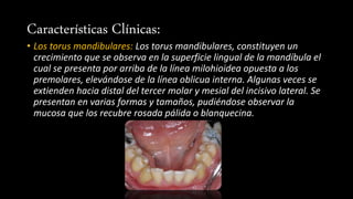 Torus palatino-y-mandibular | PPTX