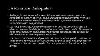 Torus palatino-y-mandibular | PPTX