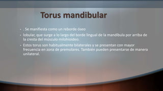 Torus y restos radiculares en prostodoncia | PPTX