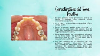 Torus palatino y mandibular | PDF