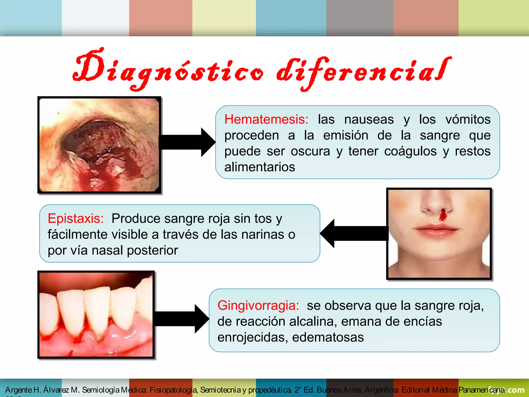 Tos - Expectoración - Hemoptisis | PPT