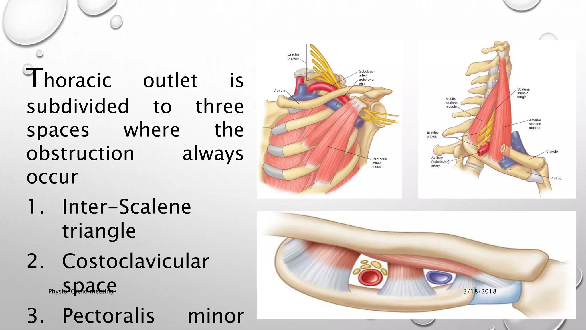 thoracic outlet syndrome | PPTX