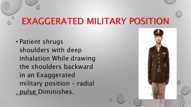 thoracic outlet syndrome
