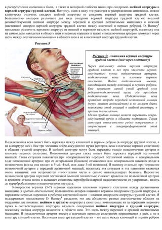 Синдром верхней апертуры грудной клетки и апертуры шеи | PDF