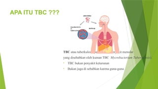 Mengenal Pencegahan, Penularan, Gejala serta Pengobatan Penyakit TBC | PPT