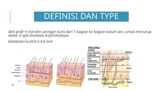operation technique of split thickness skin graft.pptx