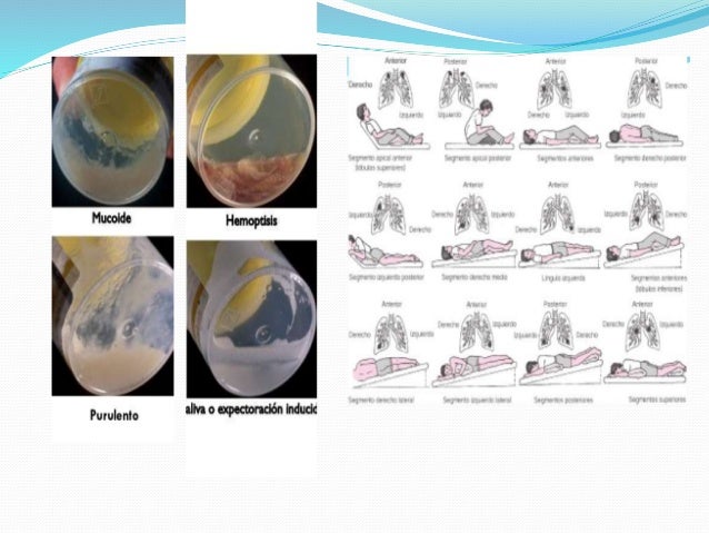 Tos y expectoracion semitología