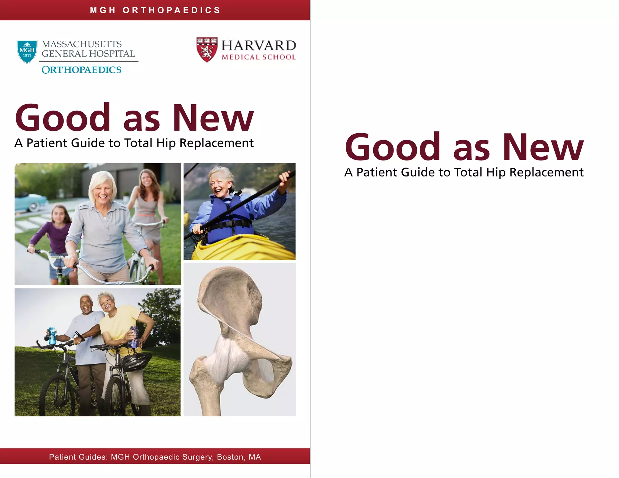 Total hip-replacement-guide | PDF