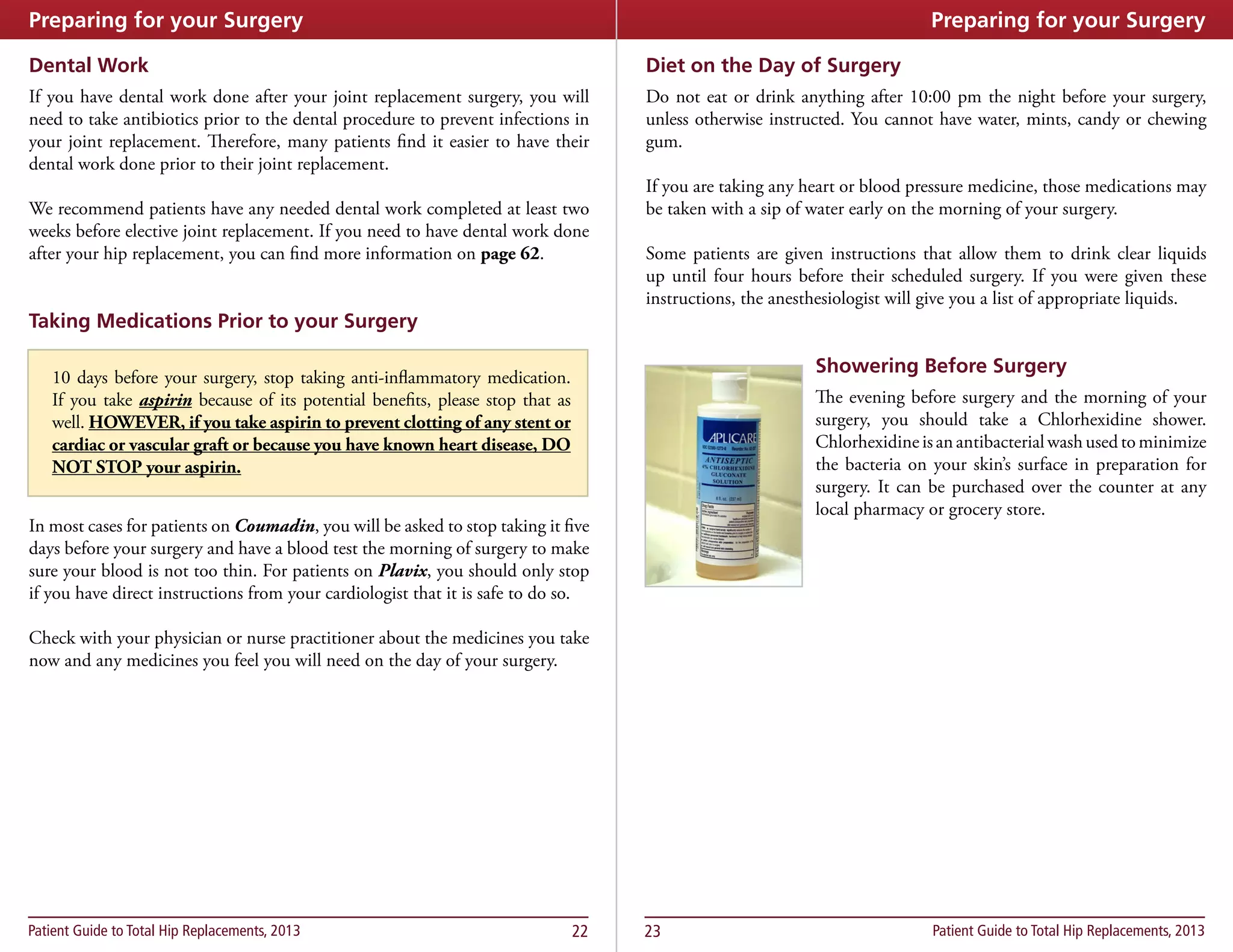 Total hip-replacement-guide | PDF