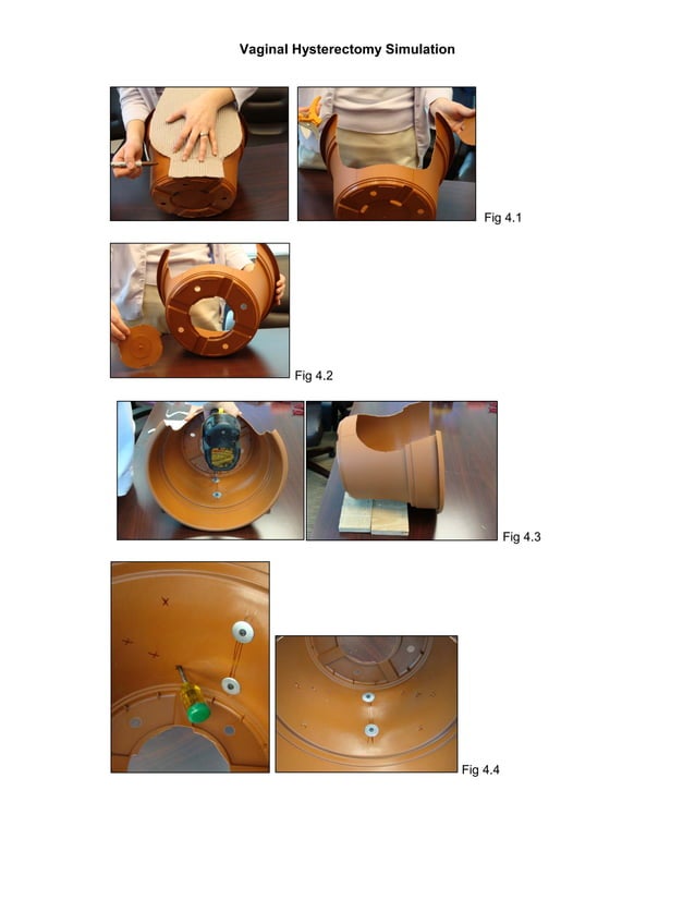 Total Vaginal Hysterectomy Simulation | PDF