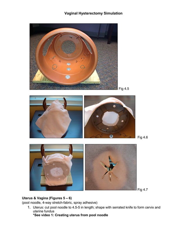 Total Vaginal Hysterectomy Simulation | PDF