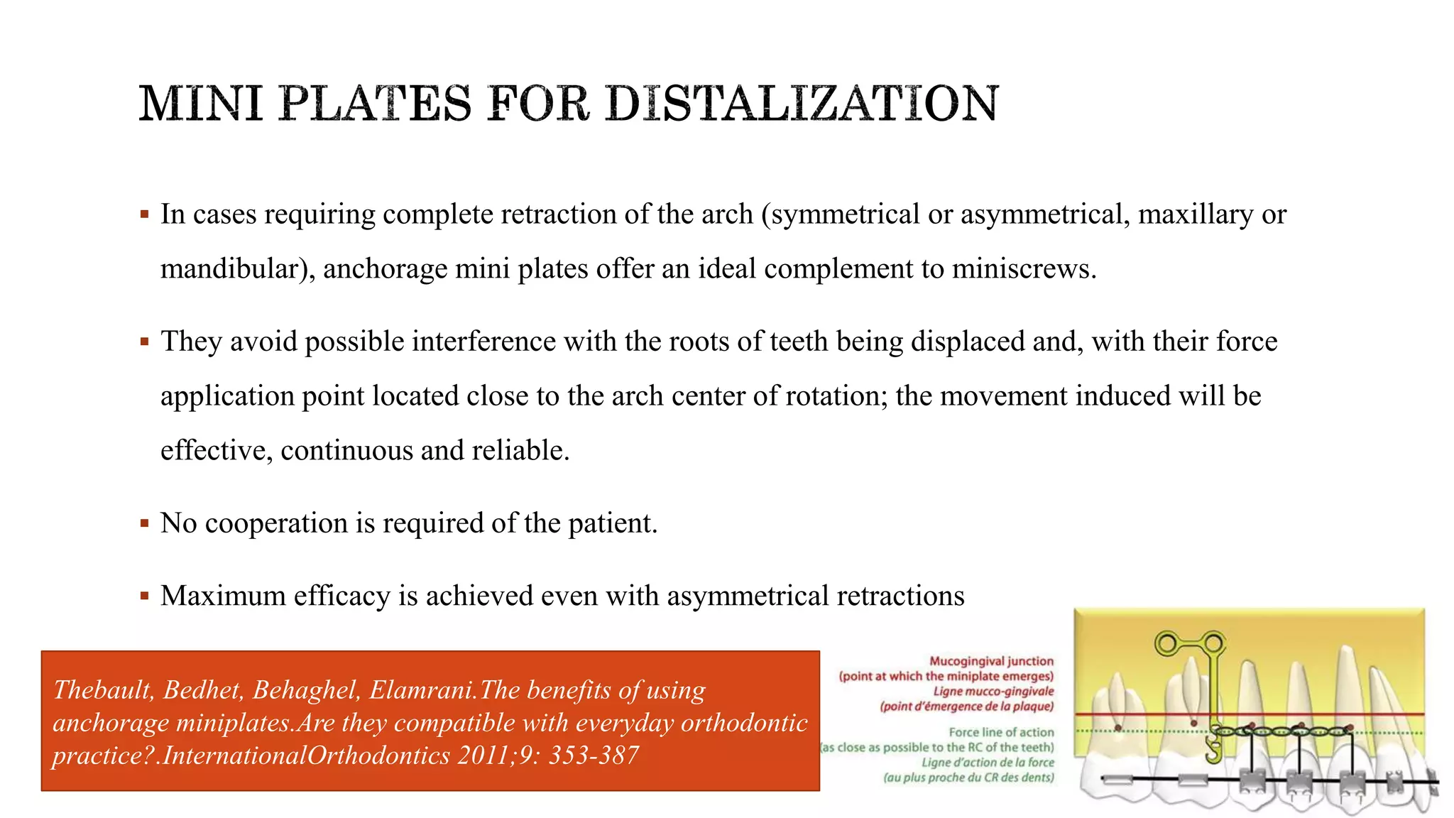 Total arch distalization in orthodontics | PPTX
