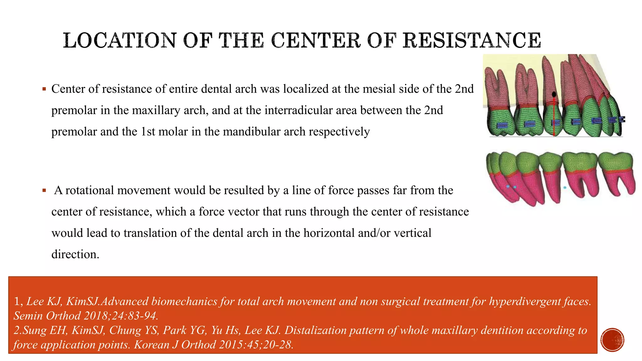 Total arch distalization in orthodontics | PPTX