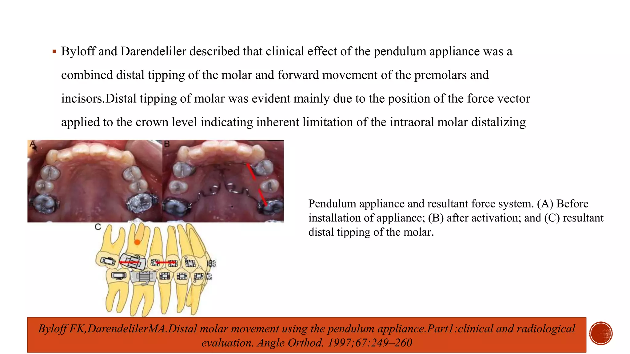 Total arch distalization in orthodontics | PPTX