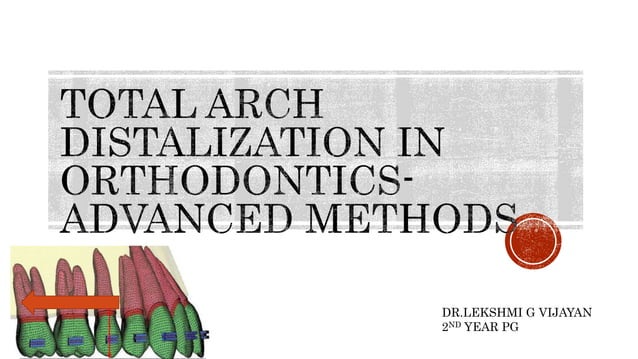 Total arch distalization in orthodontics | PPTX | Dental Health ...